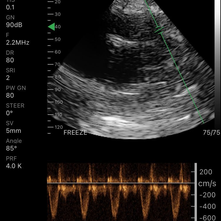 Wireless Pocket Ultrasound Clinical Gallery – SonoWave
