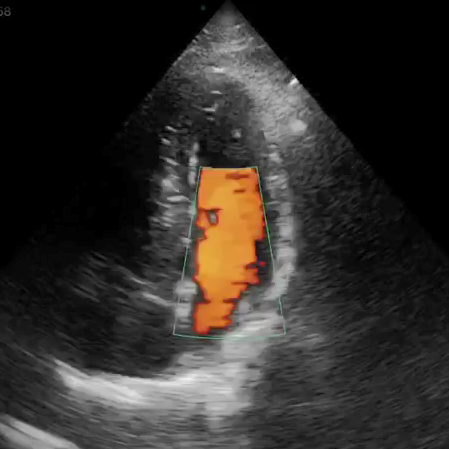 Wireless Pocket Ultrasound Clinical Gallery – SonoWave