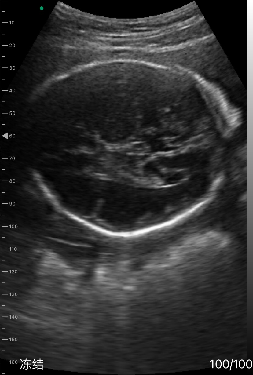 Wireless Pocket Ultrasound Clinical Gallery – SonoWave